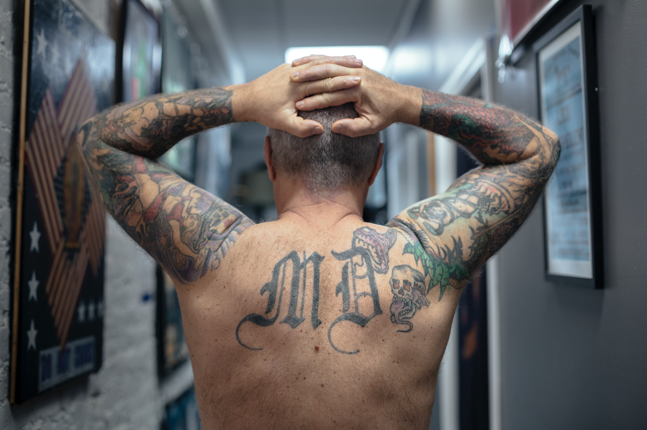 Dr Dave Tattoo Removal | Huck | Huck